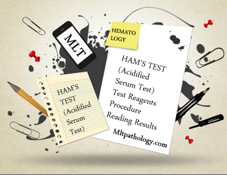 HAM'S TEST (Acidified Serum Test) And Procedure