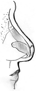 MCQ's in Facial Plastic & Reconstructive Surgery: 1401-1410 MCQ in ...