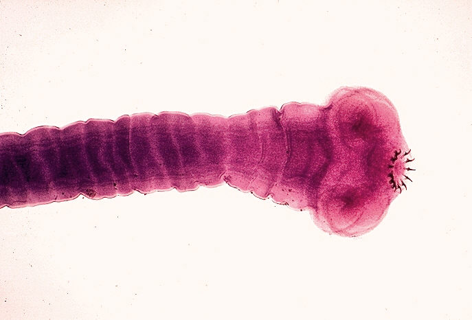 Infection Landscapes: Tapeworms