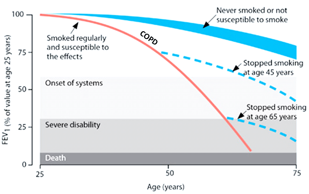 Chronic Obstructive Pulmonary Disease (COPD): By Dr Younis Khan