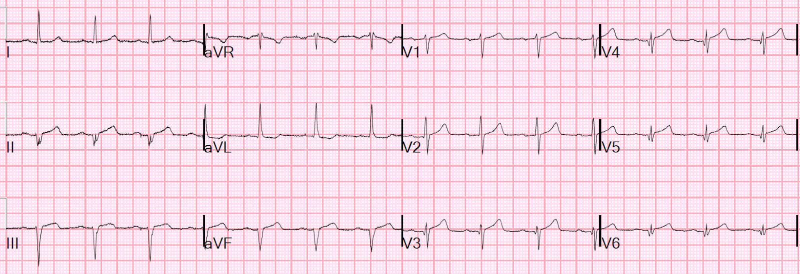 Dr. Smith's ECG Blog