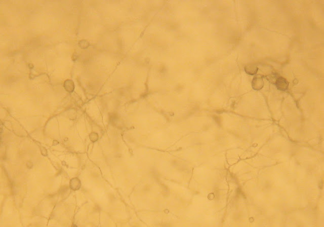 TAMU_PLPA631_FungalBlog_LornaNissen: Lab 4