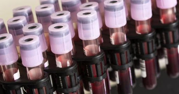 Basics of a prenatal cell-free DNA (cfDNA) screening?