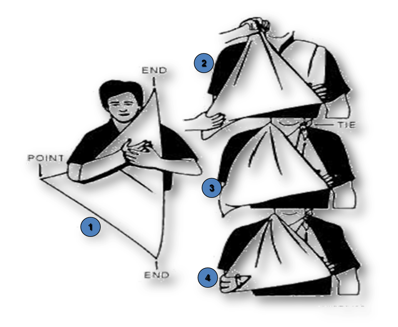 PERSATUAN BULAN SABIT MERAH SKPTLDM: Aktiviti Pertolongan Cemas: Kain Anduh