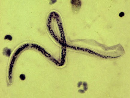 Wuchereria bancrofti