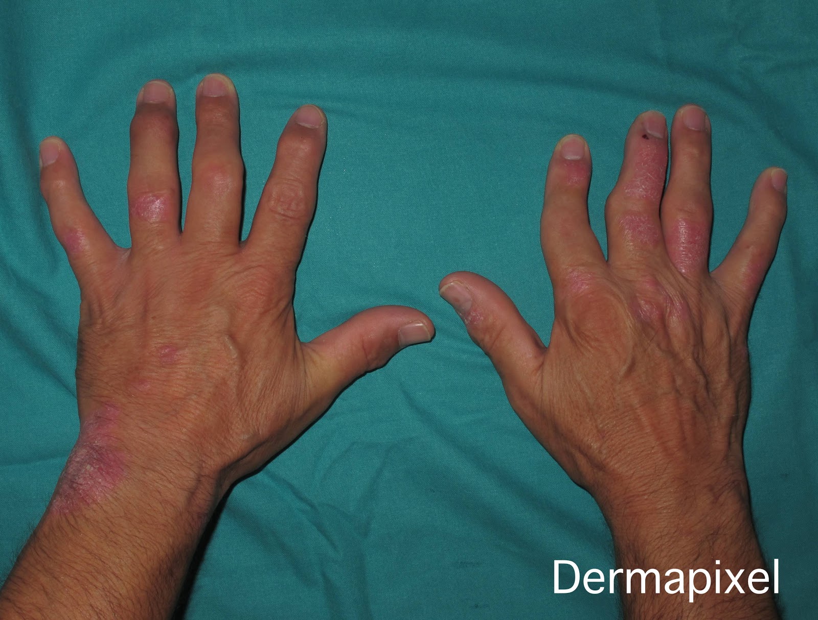 Dermapixel: agosto 2019