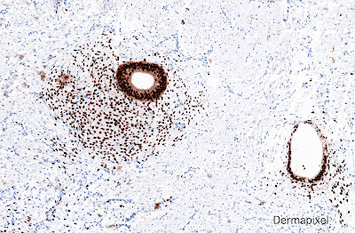 Dermapixel: abril 2021