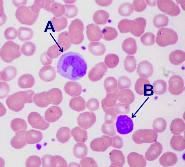 SOS BIOLOGIA CELULAR Y TISULAR: SANGRE. LEUCOCITOS. BLOOD. LEUKOCYTES