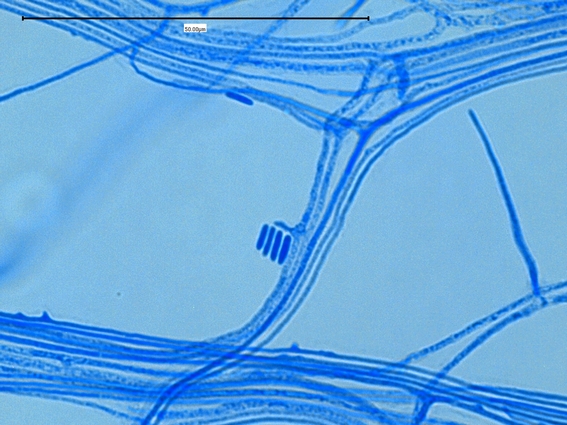 Fun With Microbiology (What's Buggin' You?): Sarocladium kiliense