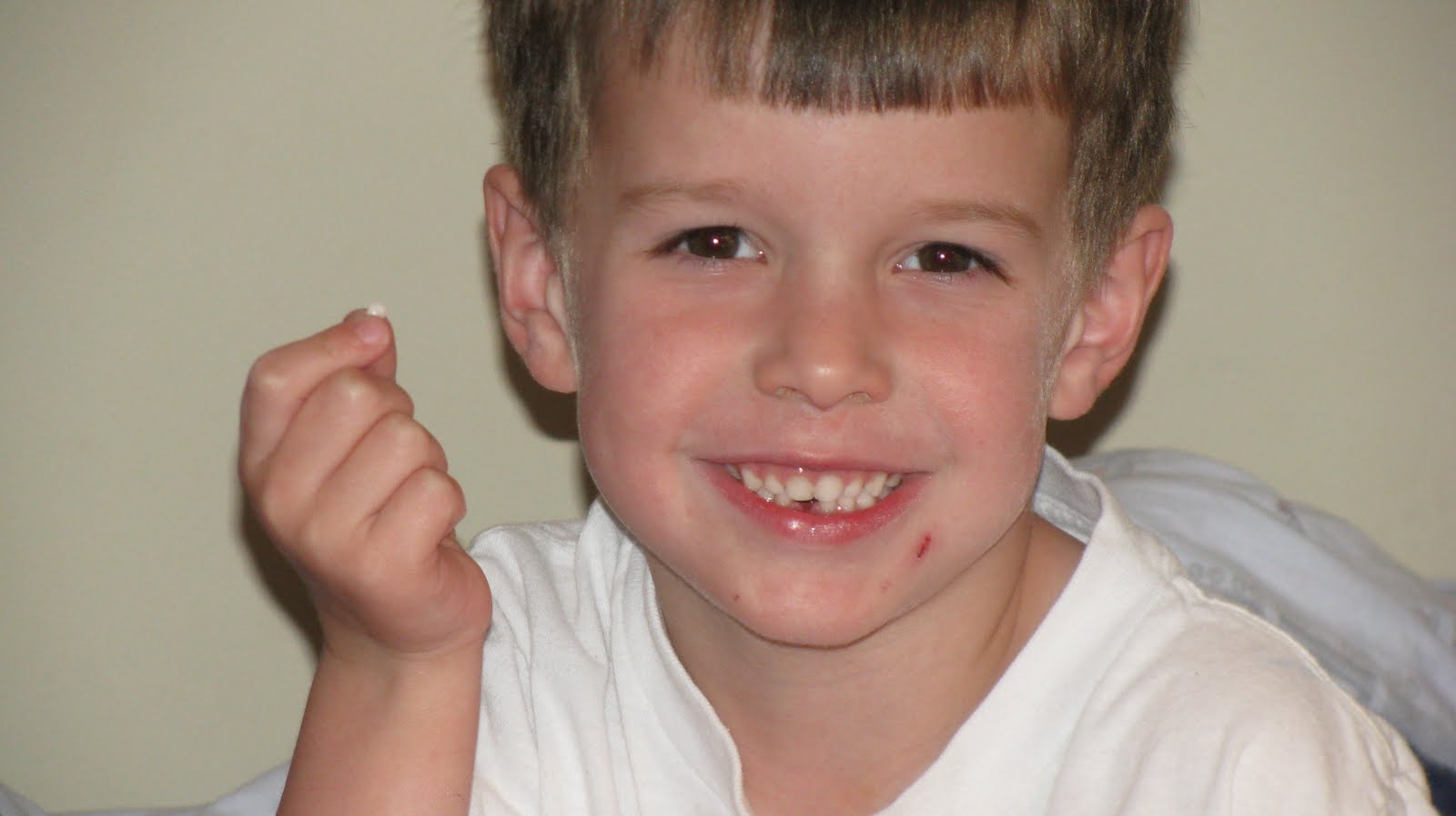 Managing Our Quiver: Introducing Snaggletooth