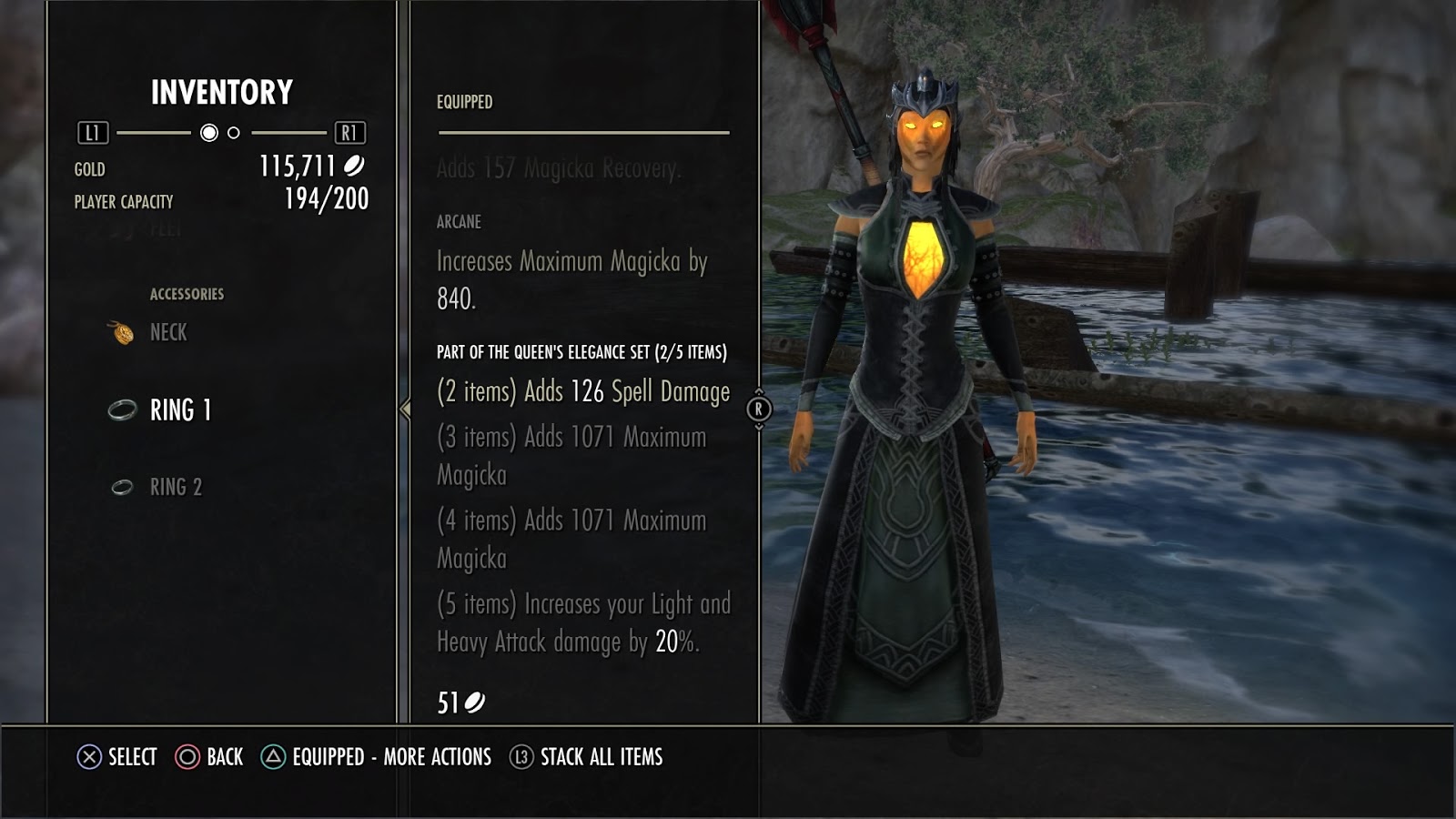 Queen's Elegance Set: A Visual