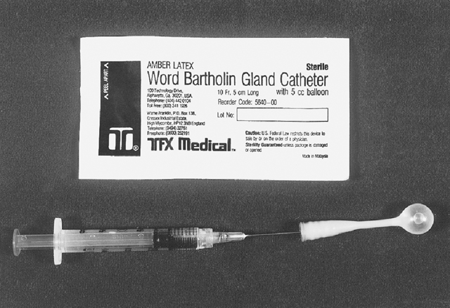 Catéter de Word para quiste de la glándula de Bartholin