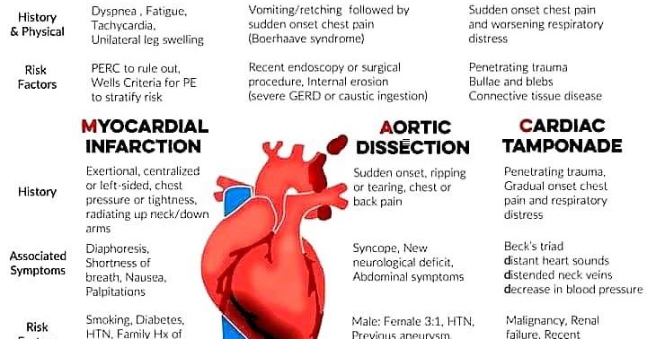 ZONA DE SALUD DE OFRA: FOAMED. Nemotecnia Dolor torácico : PET-MAC.