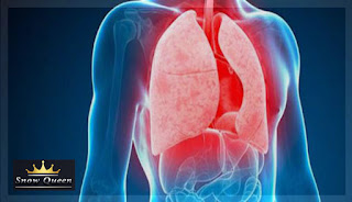 Causes of pulmonary tuberculosis symptoms and how to treat