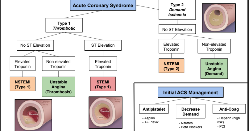 Type I NSTEMI Management & Transfusion Medicine