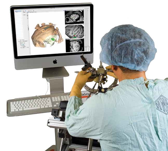 Neuro-navigation Systems Market Business Segmentation By Revenue And ...