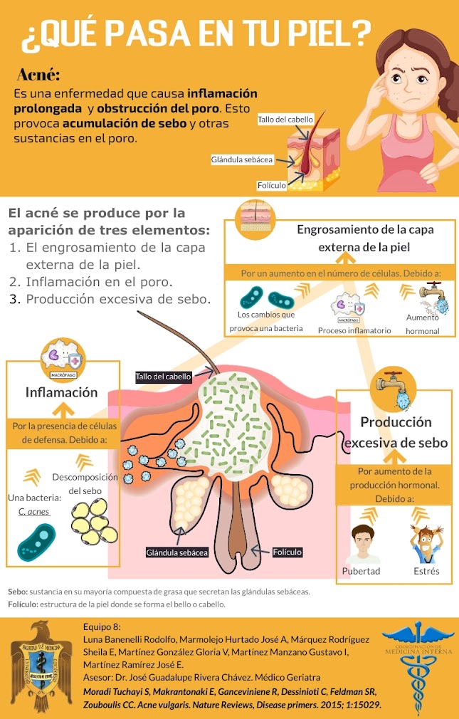 DIVULGACIÓN CIENTÍFICA UG: ¿Qué pasa en tu piel? Acné