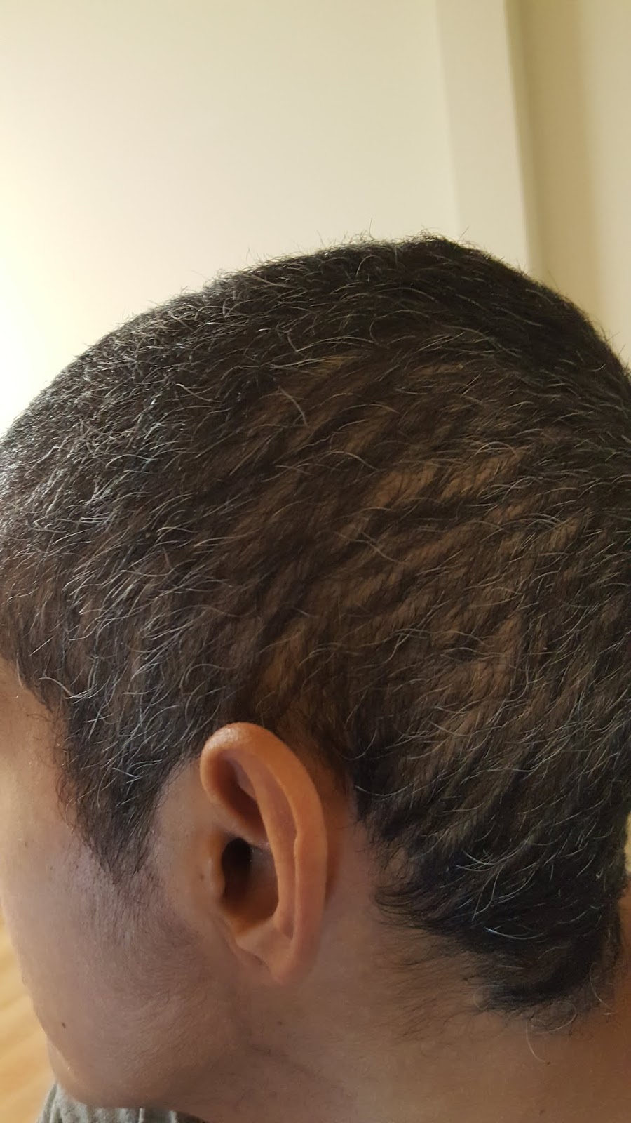 More than My Diagnosis: Radiation: Starting week 3 and Talking about ...