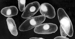 Cisticercosis - Tratamiento ~ MEDICINA CLÍNICA Y QUIRÚRGICA