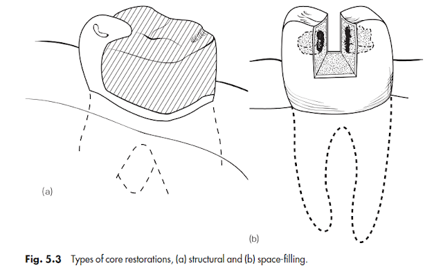 Dentistry and Medicine: Core restorations-Restorative Dentistry Lecture ...