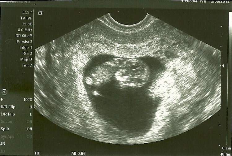 Refrigerator Memories: 10 Week Belly Bump