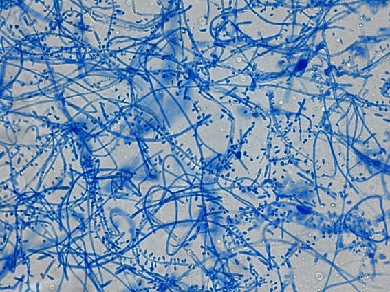 Ringworm (Dermatophytosis) pada Sapi - Mydokterhewan