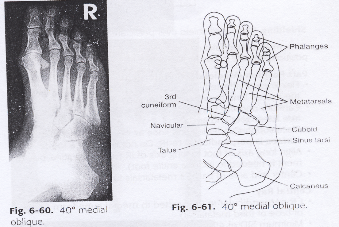 Catatan Ku: Teknik Radiografi Os Pedis