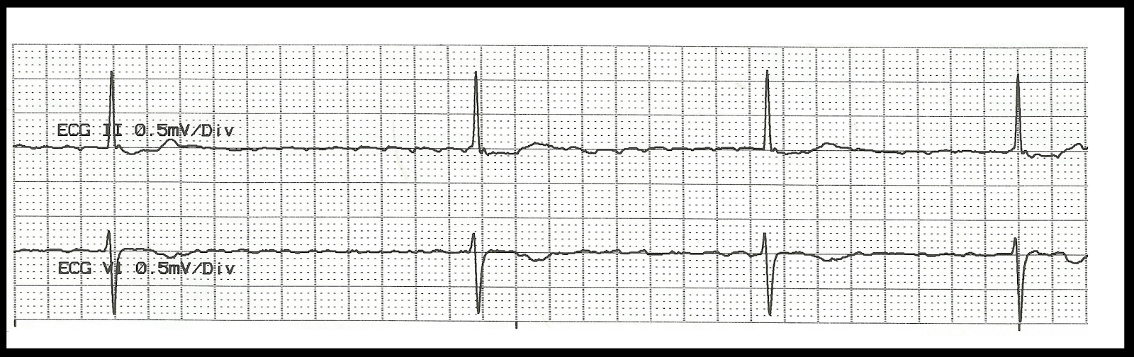 EKG Rhythm Strip Quiz 193
