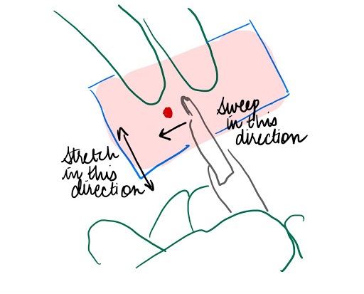 Medicowesome: Skin biopsy techniques