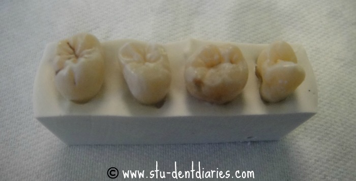 Stu-DENT Diaries: 01/01/2012 - 02/01/2012