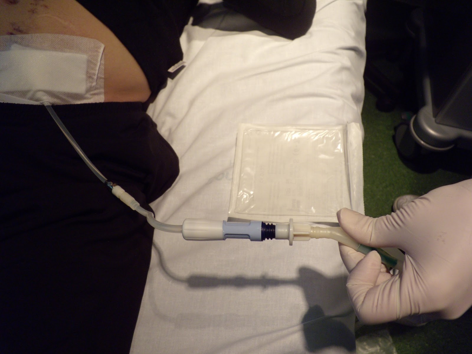 Diálisis, diario para principiantes: Diálisis peritoneal : Cuidados del ...