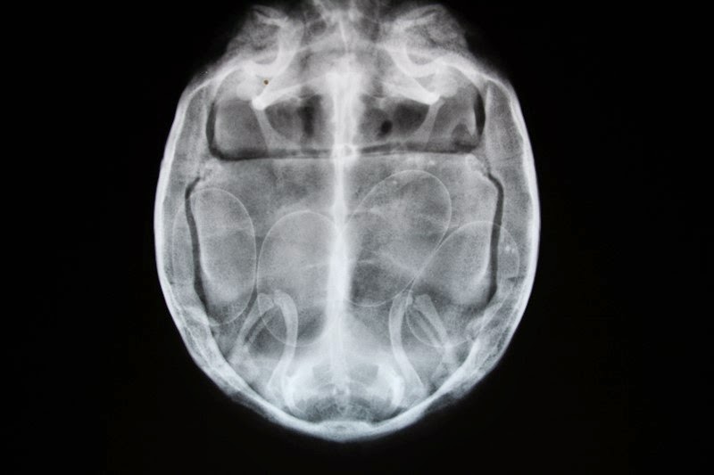 Clemmys guttata: la tortuga moteada