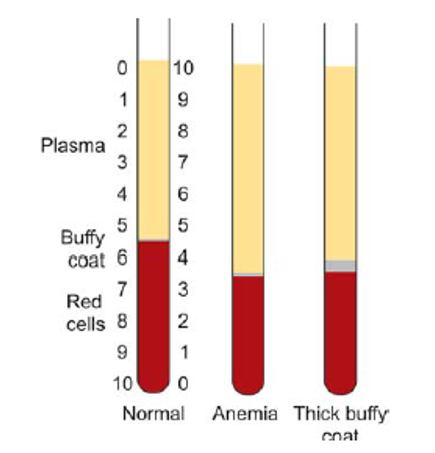 Packed cell volume (PCV)