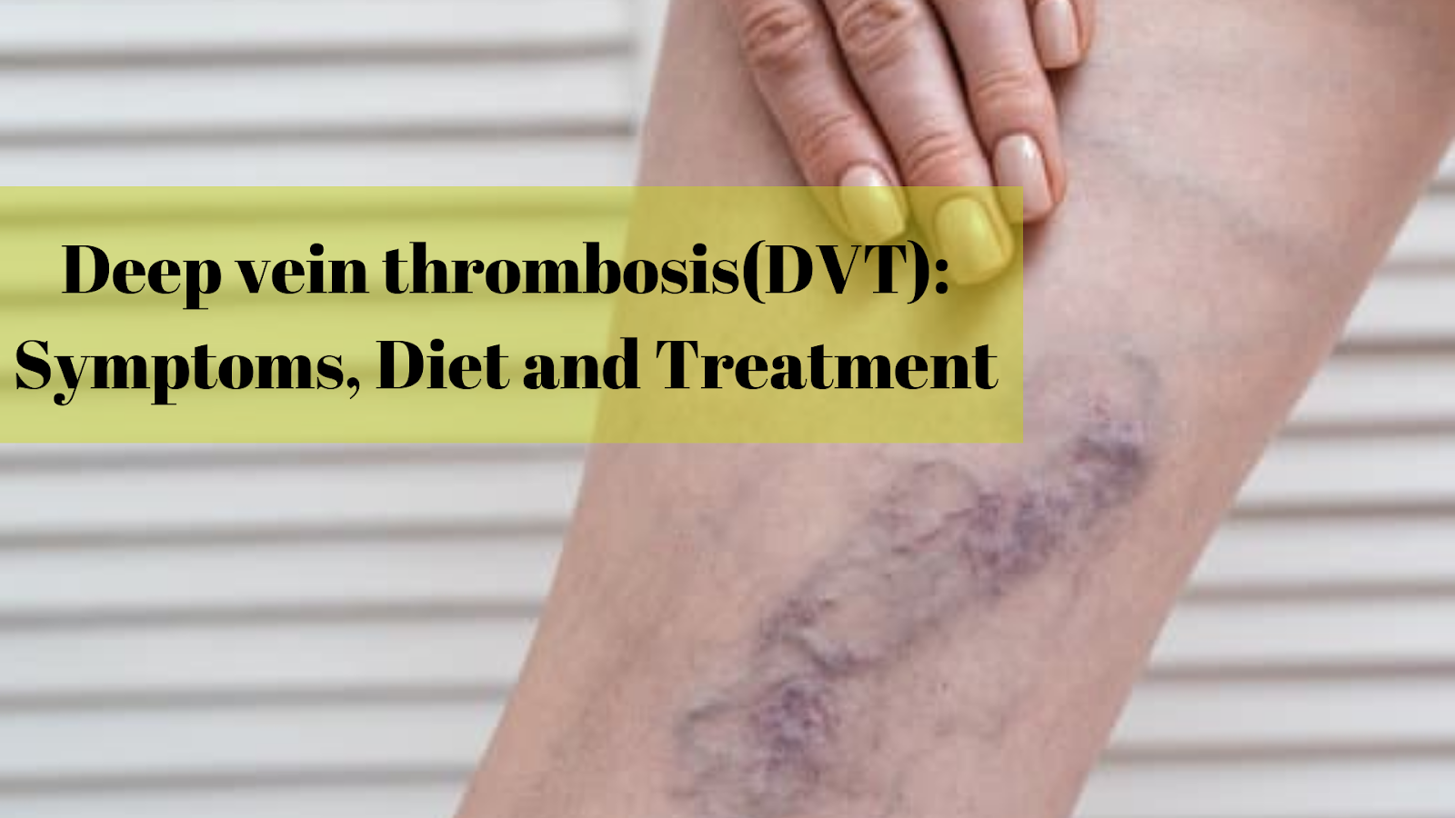 Deep Vein Thrombosis Dvt Symptoms Treatment Causes An