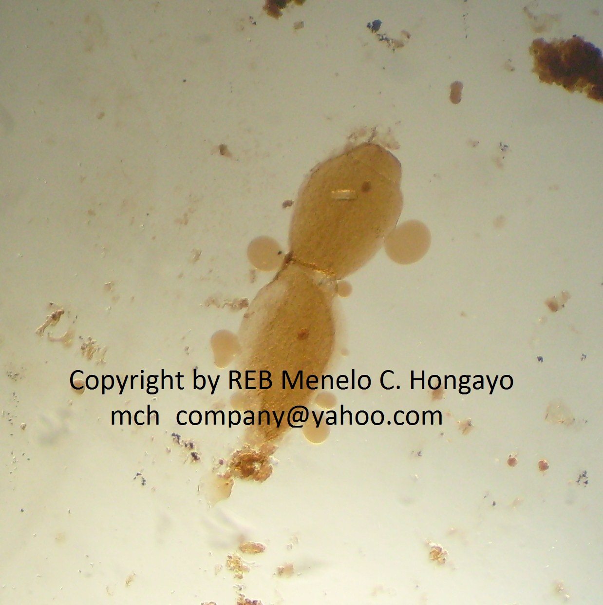 MCH unlimited for Science: Gregarina sp