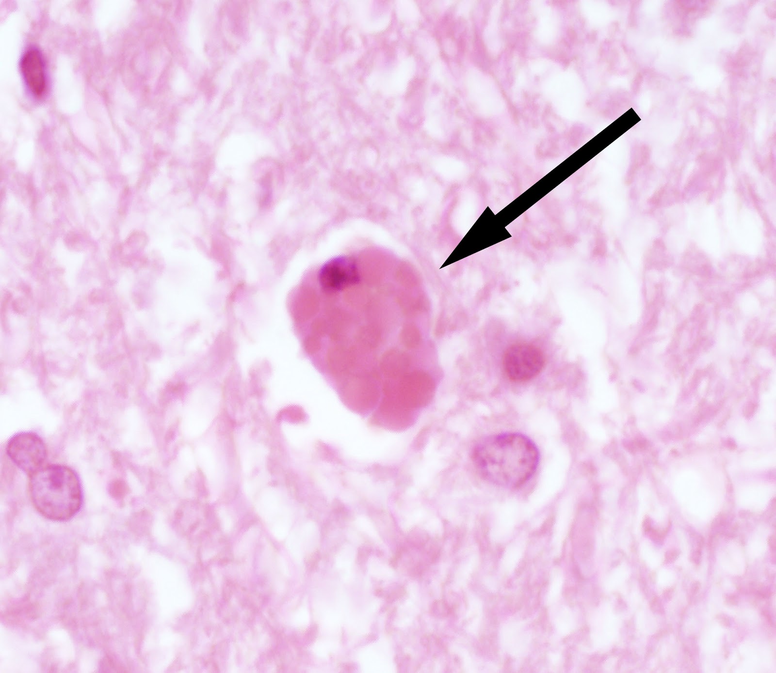 Creepy Dreadful Wonderful Parasites: April 2013