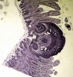 Under the Microscope: Taenia solium and the leaky brain cyst