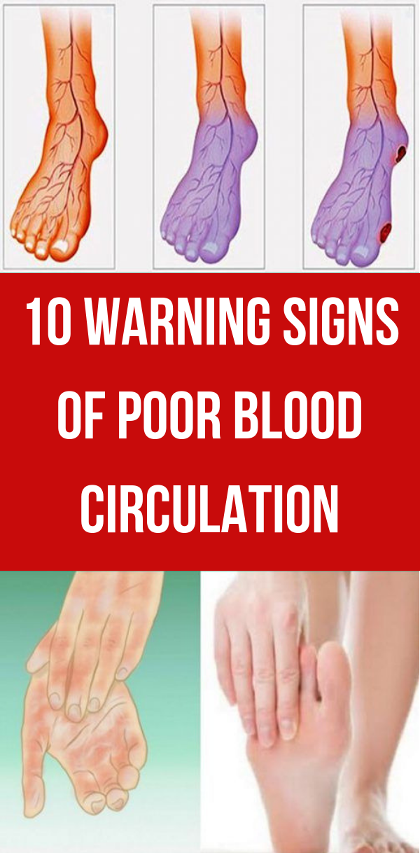 Herbal Medicine: 10 Warning Signs Of Poor Blood Circulation