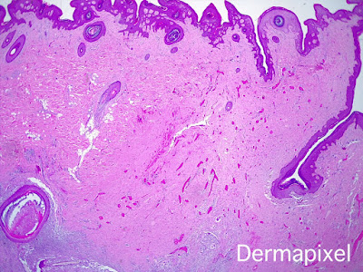 Dermapixel: agosto 2019