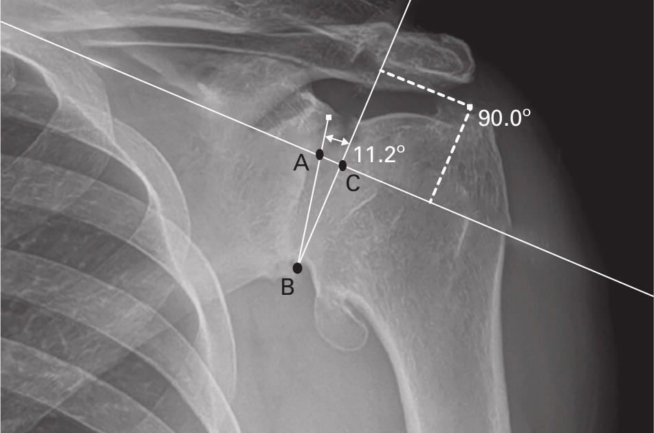 Revisiones_bibliográficas TyO_Web: Reevaluación de la inclinación ...