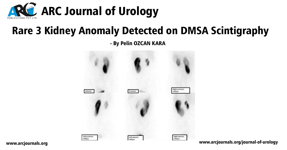 Rare 3 Kidney Anomaly Detected on DMSA Scintigraphy ~ ARC Journals