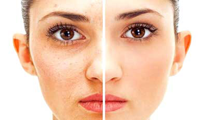 Tienes Que Ver Los Secretos Para Tener Tu Cutis Perfectos. | ENFOKE LATINO