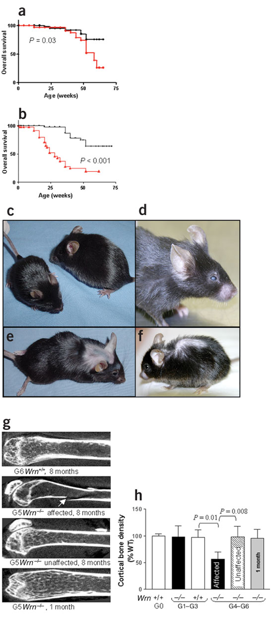 Cancer Biology: Werner Syndrome: Aging in Fast Forward
