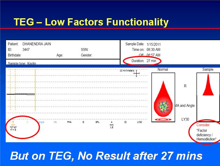 Thromboelastography TEG Analyzer Liver Transplant Cardiac Surgery India ...
