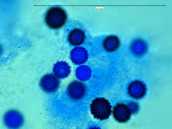 Fun With Microbiology (What's Buggin' You?): Sepedonium species