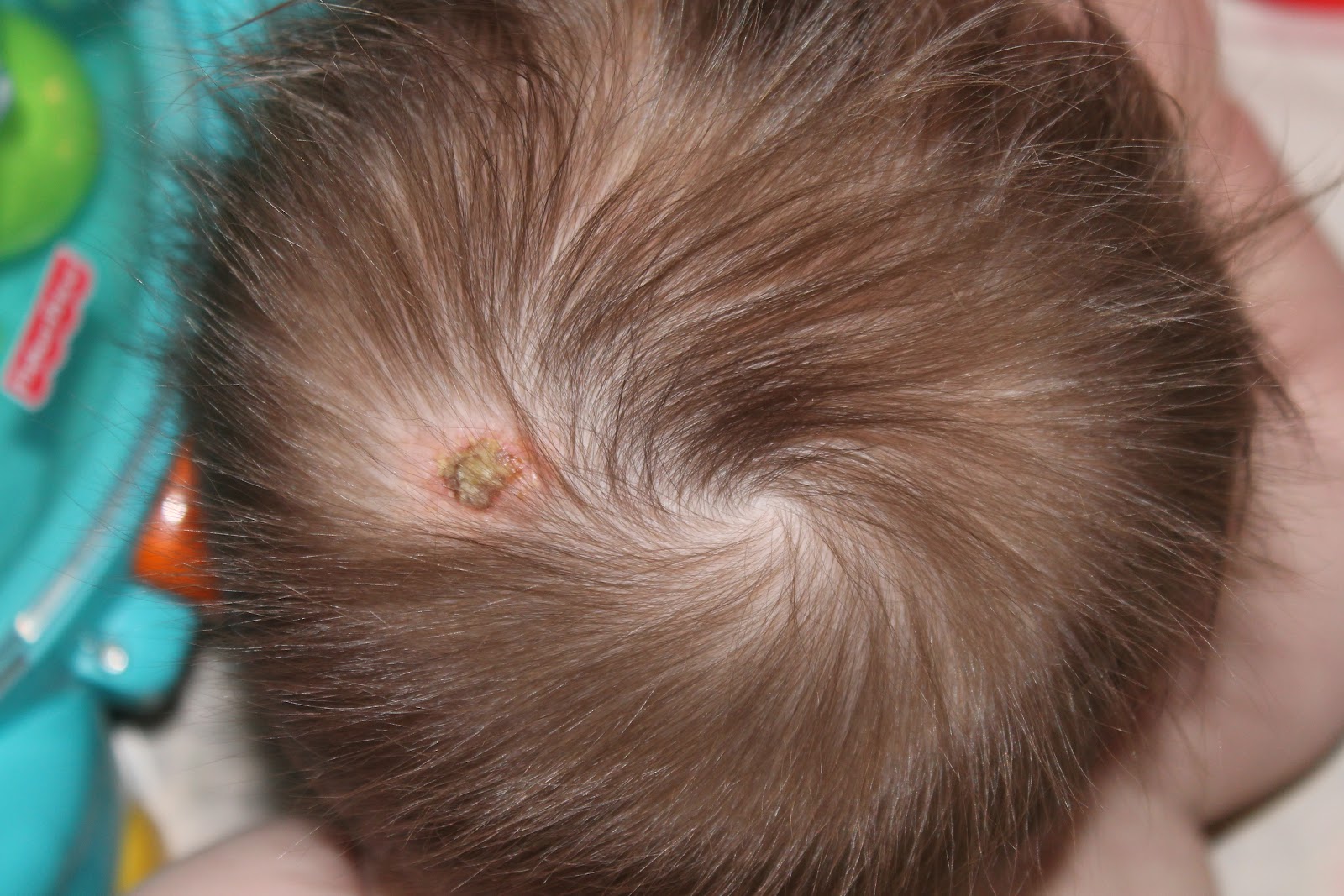 Everybody's Gonna Love Today: Cutting Teeth