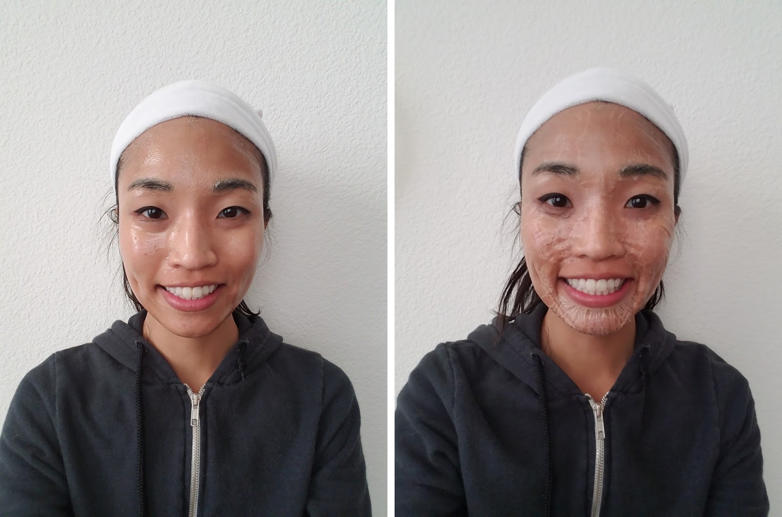 Smelly but *so* worth it: Skin1004 Zombie Pack with Activator | THE JEN ...