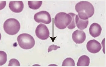 HEMATOLOGÍA: Serie Roja