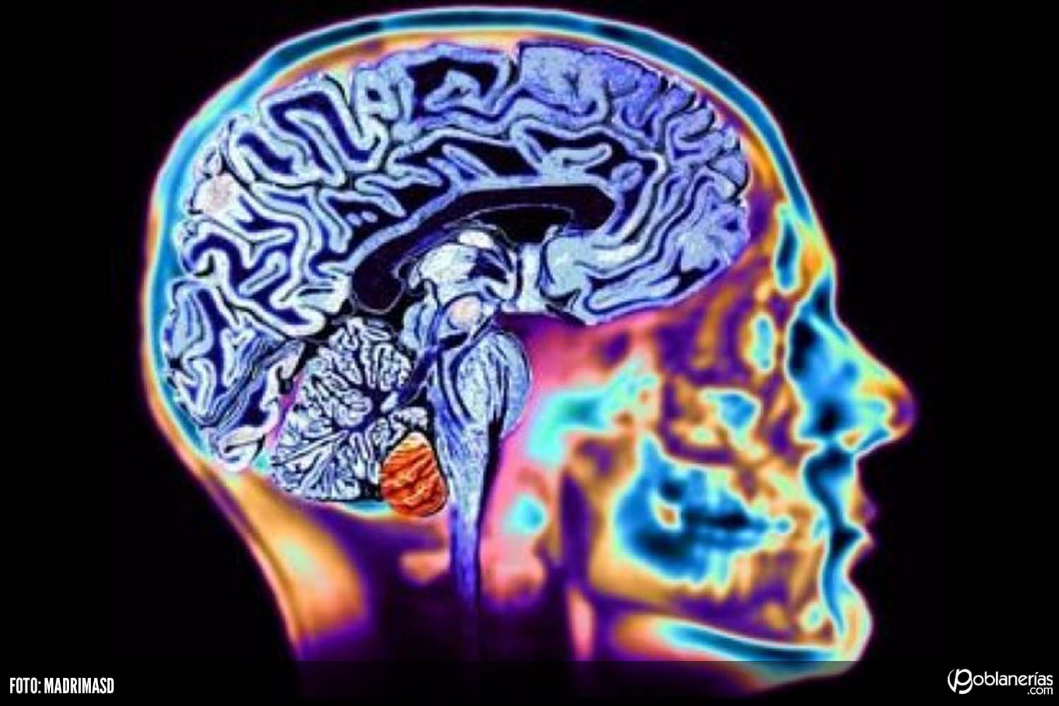 Huntington México Blog: Mal de San Vito afecta a la Región del Caribe