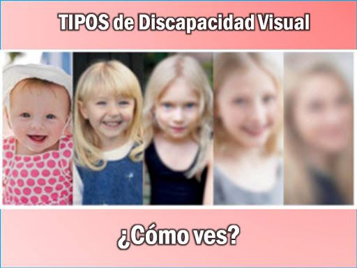 COMPRENDIENDO LA DISCAPACIDAD: ¿Qué es discapacidad visual y cuáles son ...